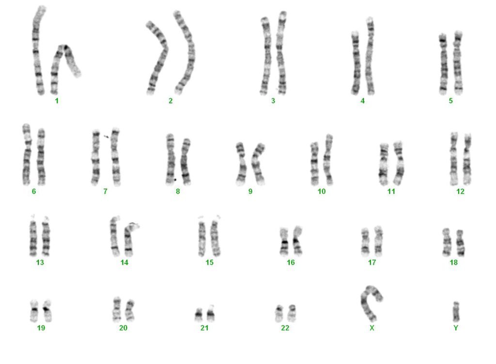 Chromosomenanalysen – allgemeine Informationen - DNA-Diagnostik Hamburg ...