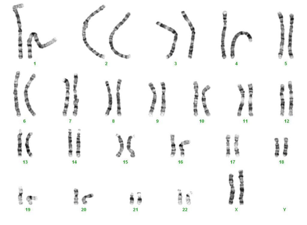 Chromosomenanalysen – allgemeine Informationen - DNA-Diagnostik Hamburg ...